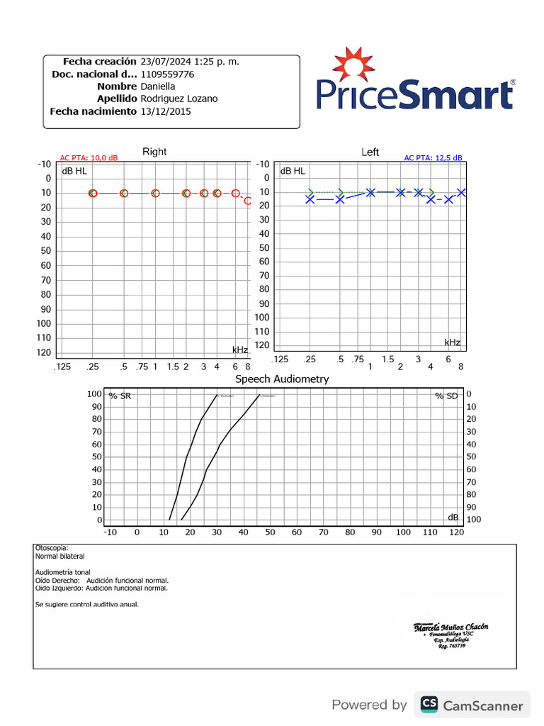 Audiometría de Daniella Rodríguez 2024 | PDF | Ingeniería de audio | Tecnología de sonido