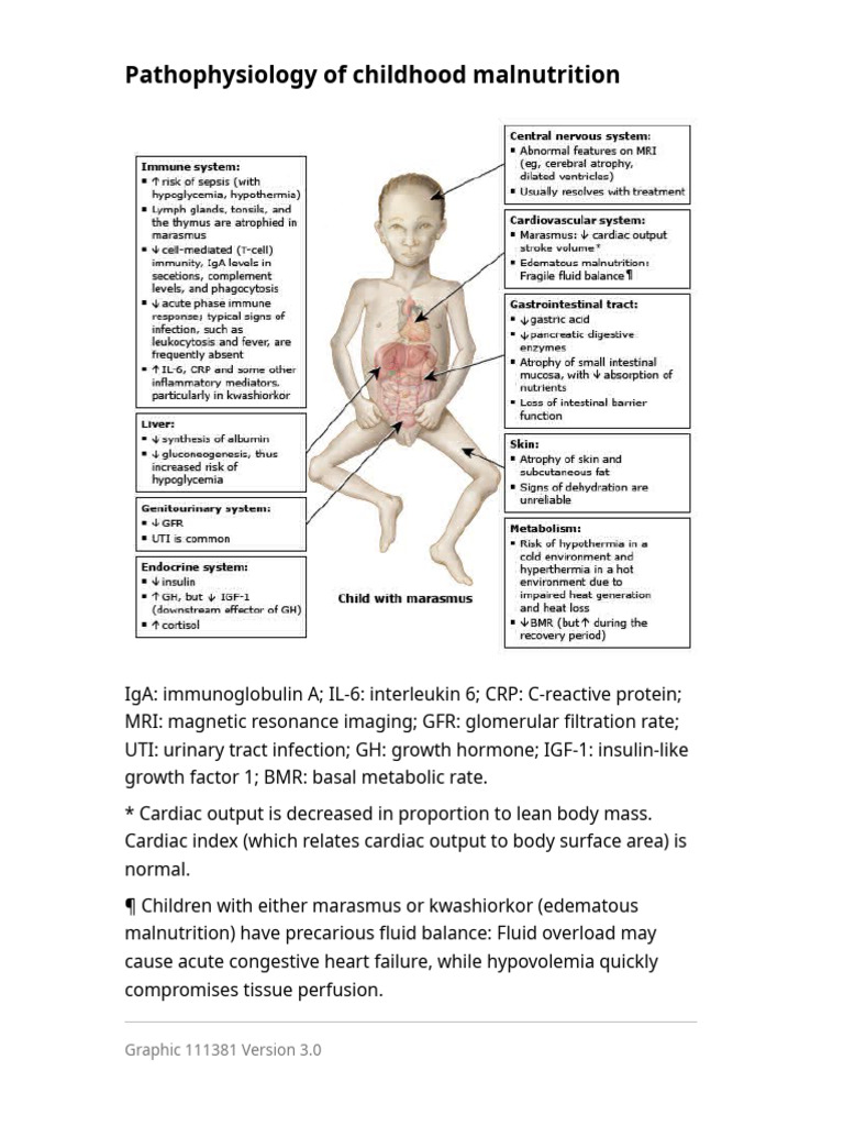 Pathophysiology of Malnutrition | PDF