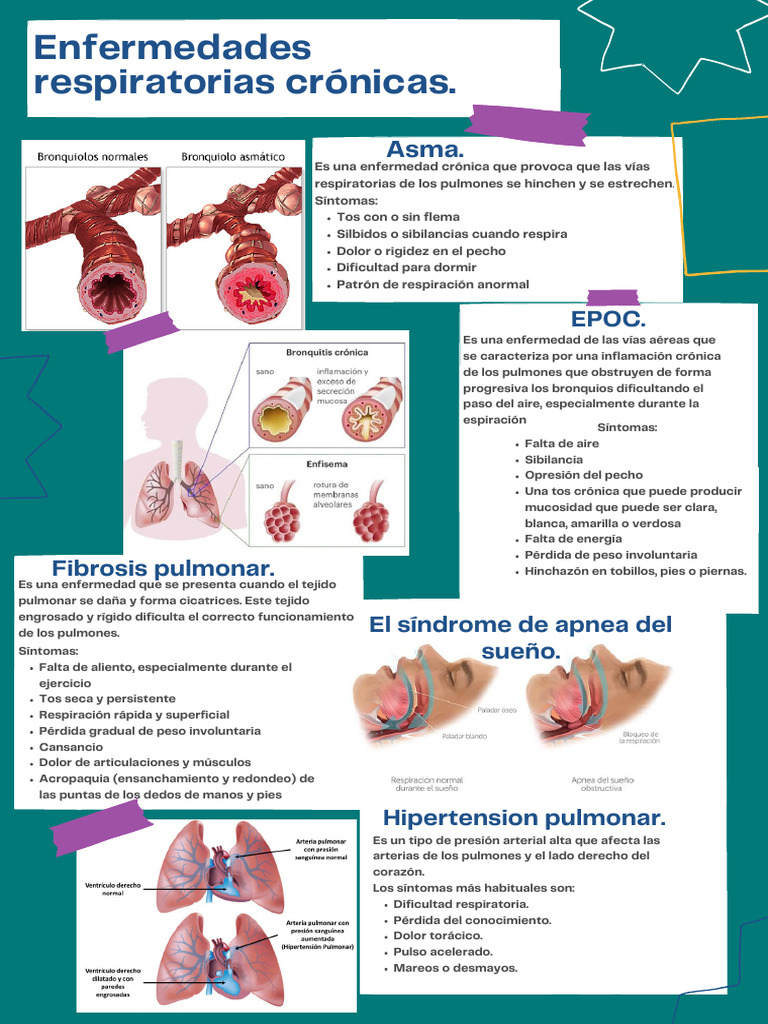 Cartel de ERC | PDF | Pulmón | Tos