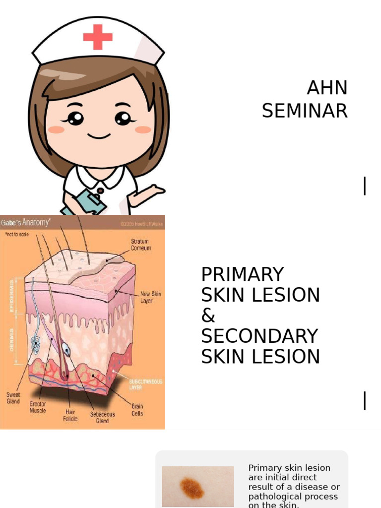 Roll No. 47 Primary Skin Lesion and Secondary Skin Lesion | PDF