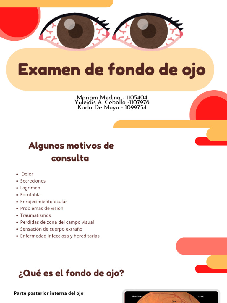 Examen de Fondo de Ojo | PDF | Ojo humano | Especialidades Medicas