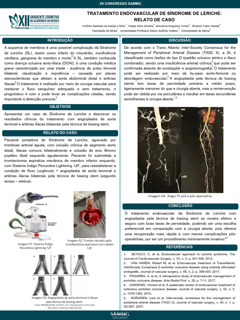 Pôster Tratamento Endovascular de Síndrome de Leriche Relato de Caso-1 ...