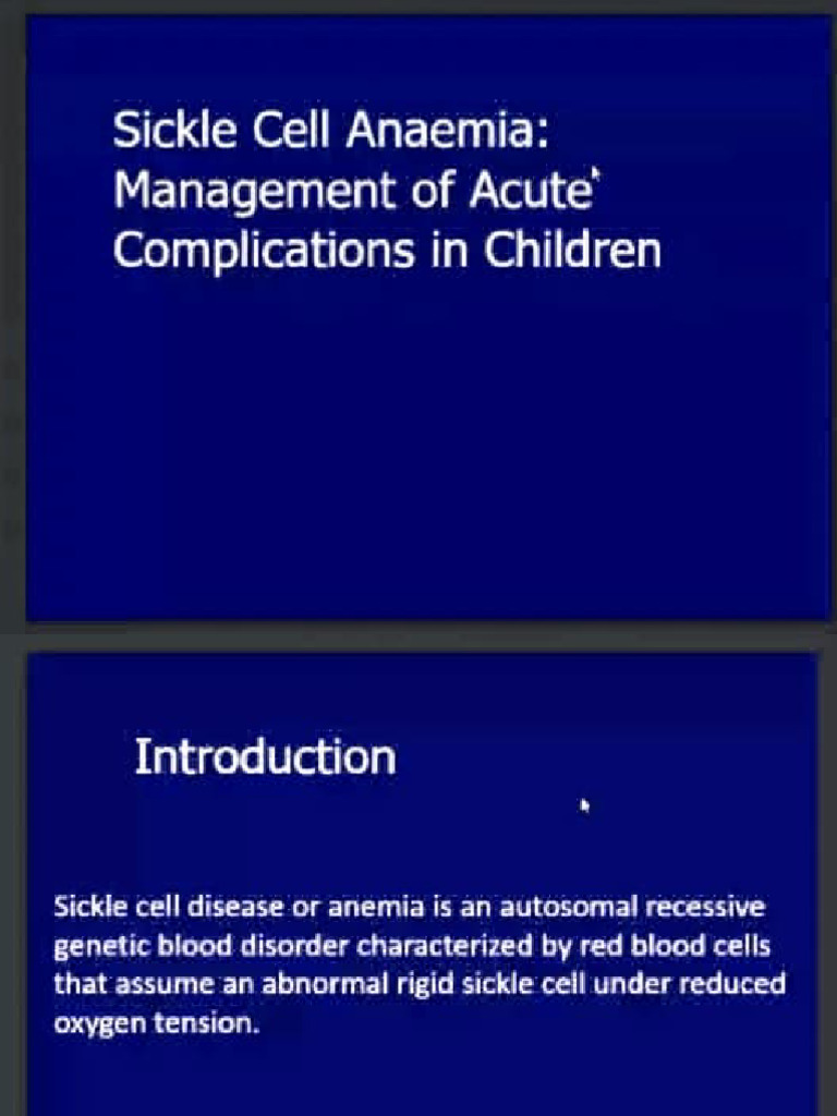 Sickel Cell Disease Management of Acute Crisis and Complications. | PDF