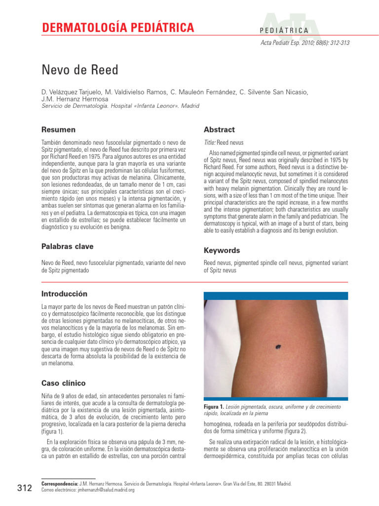 Dermatologia Nevo 1 | PDF | Epidermis | Melanoma
