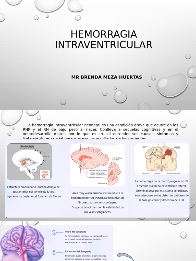 Hemorragia Intraventricular: MR Brenda Meza Huertas | PDF