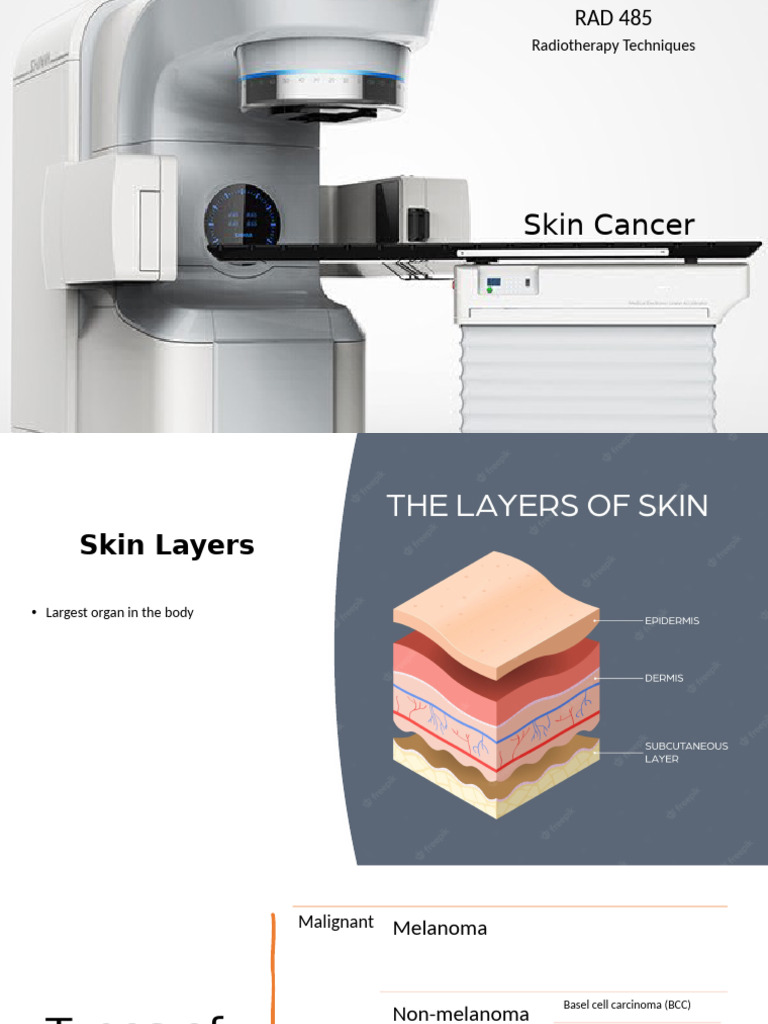 Skin Cancer | PDF | Cancer | Radiation Therapy