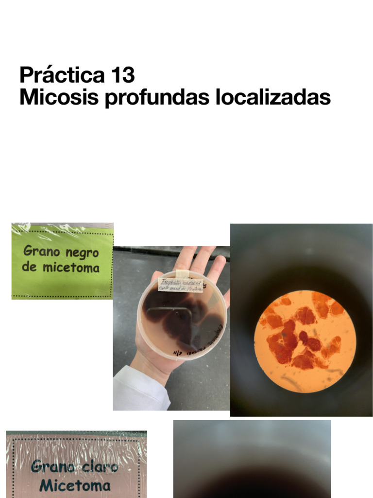 micosis profundas | PDF