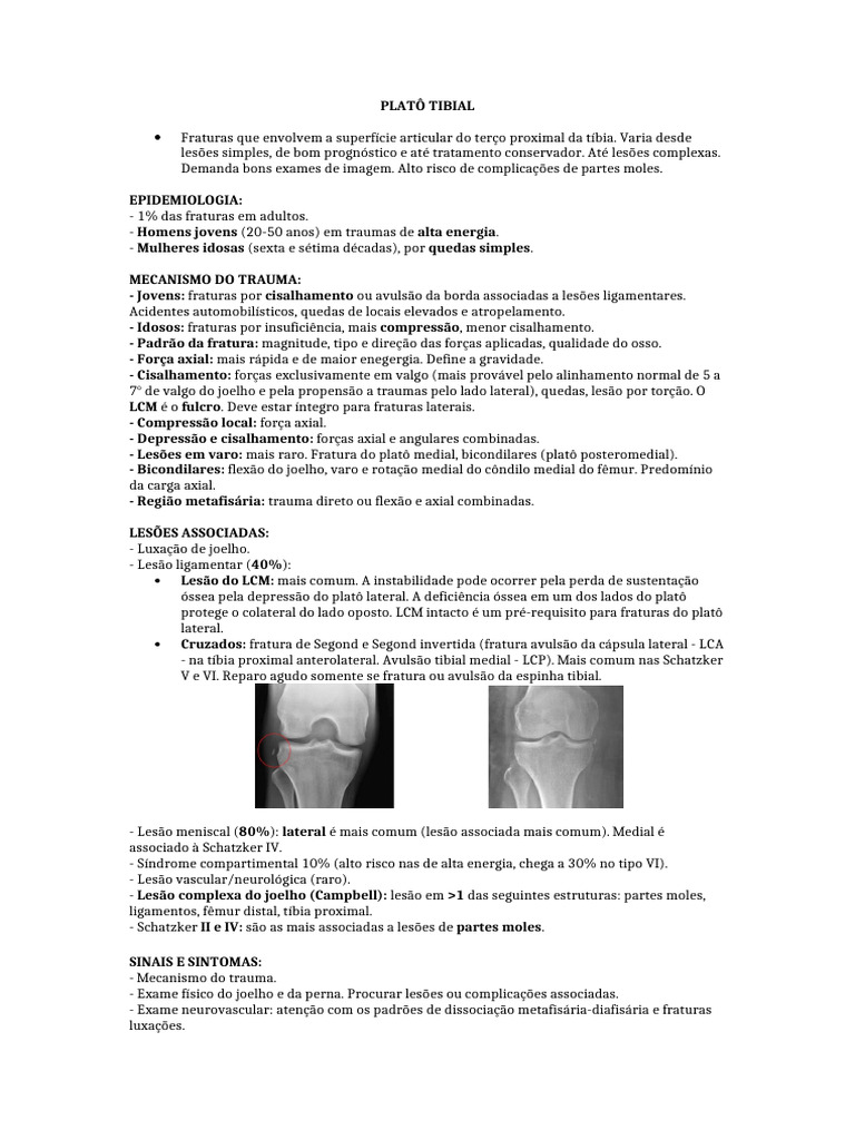 Fraturas do Platô Tibial: Causas e Tratamento | PDF | Joelho | Sistema ...