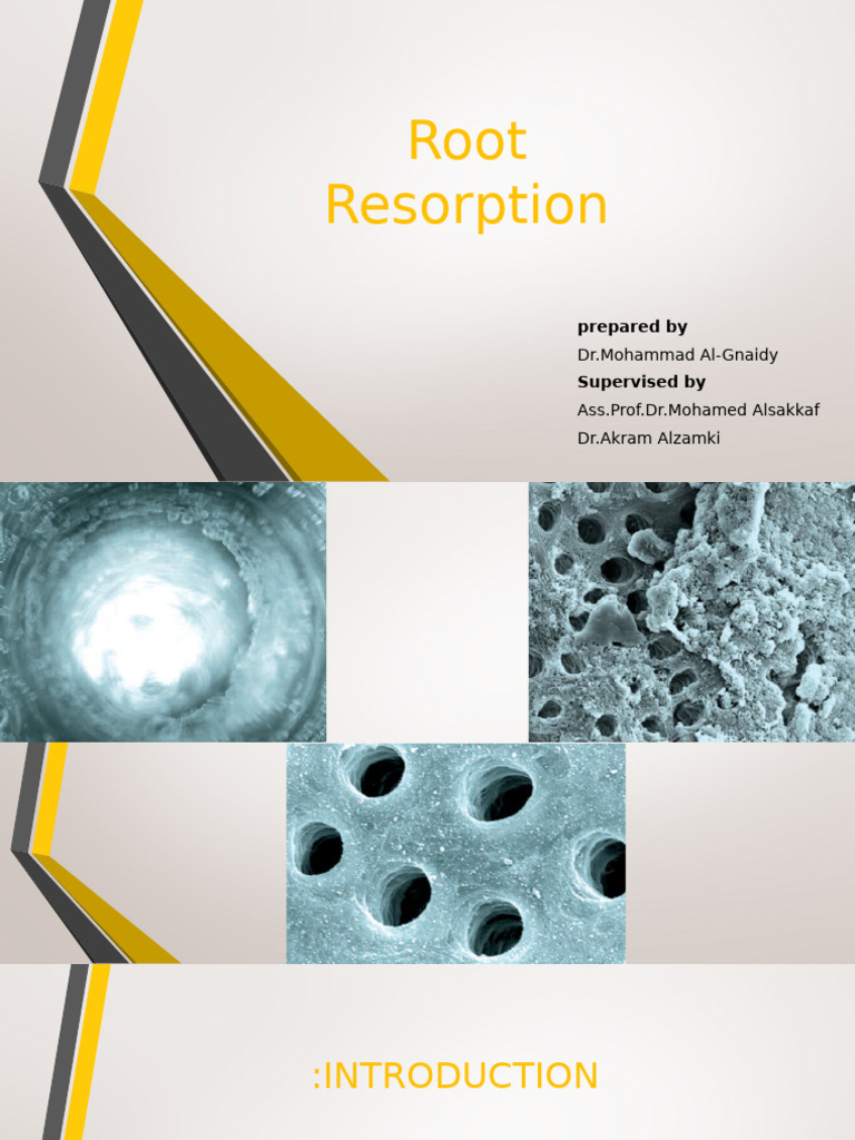 Understanding Root Resorption in Dentistry | PDF | Extracellular Matrix ...