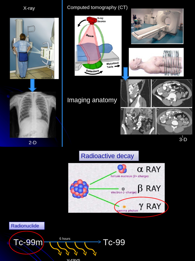 Pulmonary Nuclear Medicine Imaging Guide | PDF | Lung | Nuclear Medicine