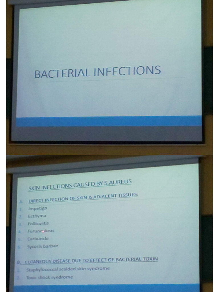 Bacterial Infections (DR Reema Mirza) | PDF