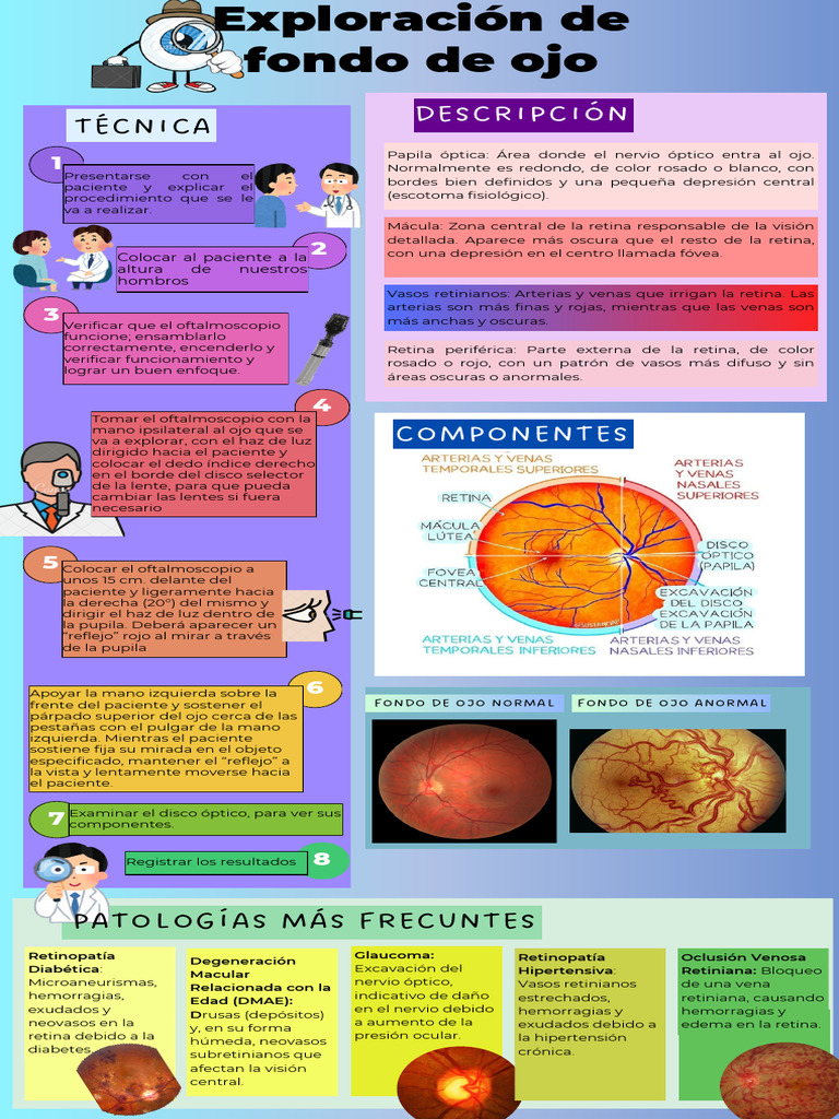 Infografia Fonde de Ojo | PDF | Ojo humano | Ojo