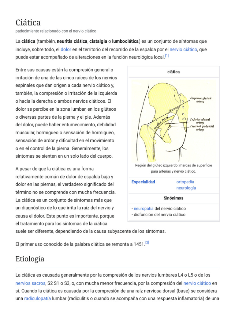 Causas y síntomas de la ciática | PDF | Especialidades Medicas ...