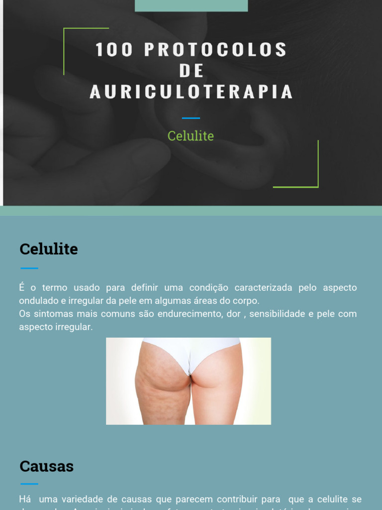 Auriculoterapia para Celulite | PDF