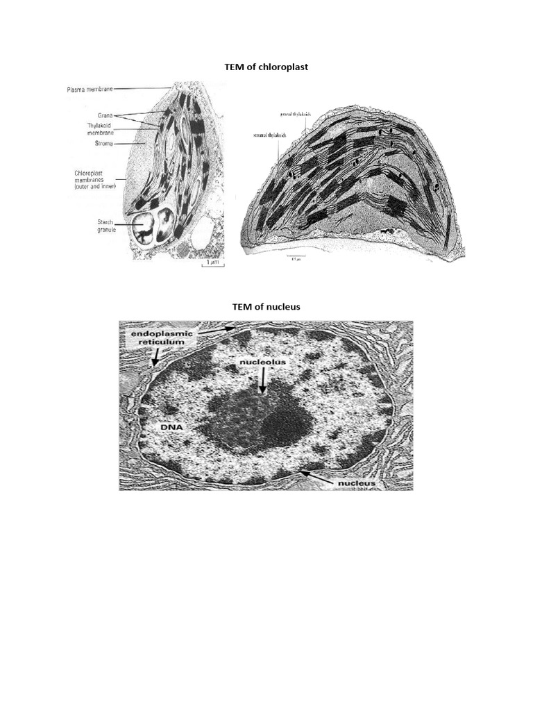 Electronmicrograph of Cell Organells | PDF