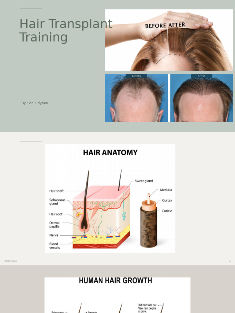 Hair Transplant Training Methods | PDF