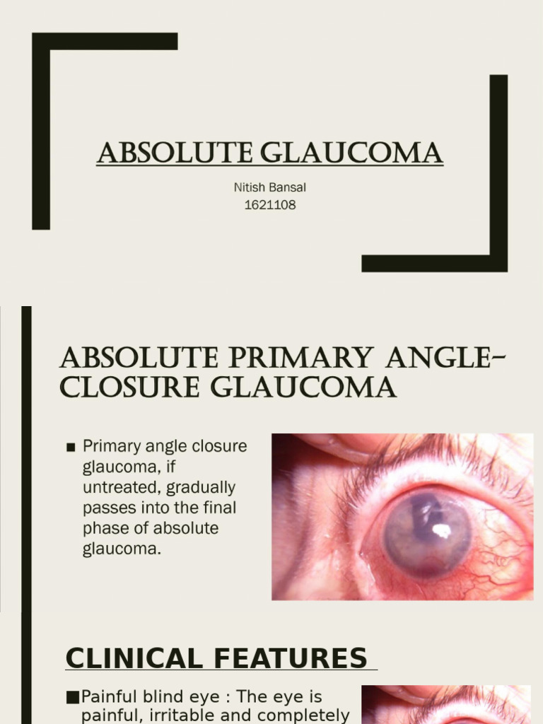 Absolute Glaucoma (1621108) | PDF