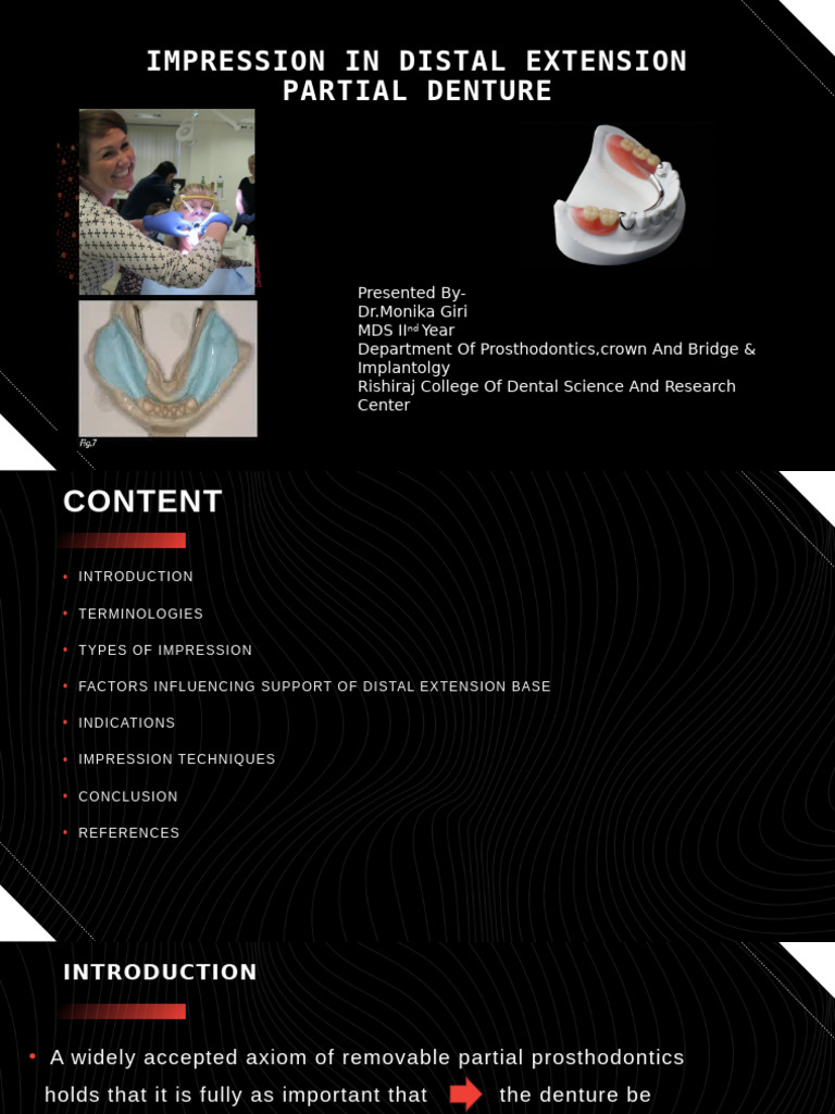 Impression in Distal Extension RPD | PDF | Dentures | Dentistry Branches