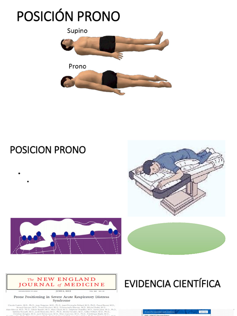 Posicion Prono | PDF | Especialidades Medicas | Medicina CLINICA