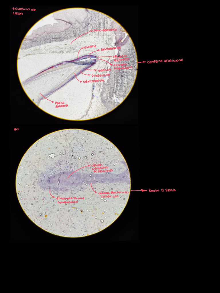 Odontogenesis preparados | PDF