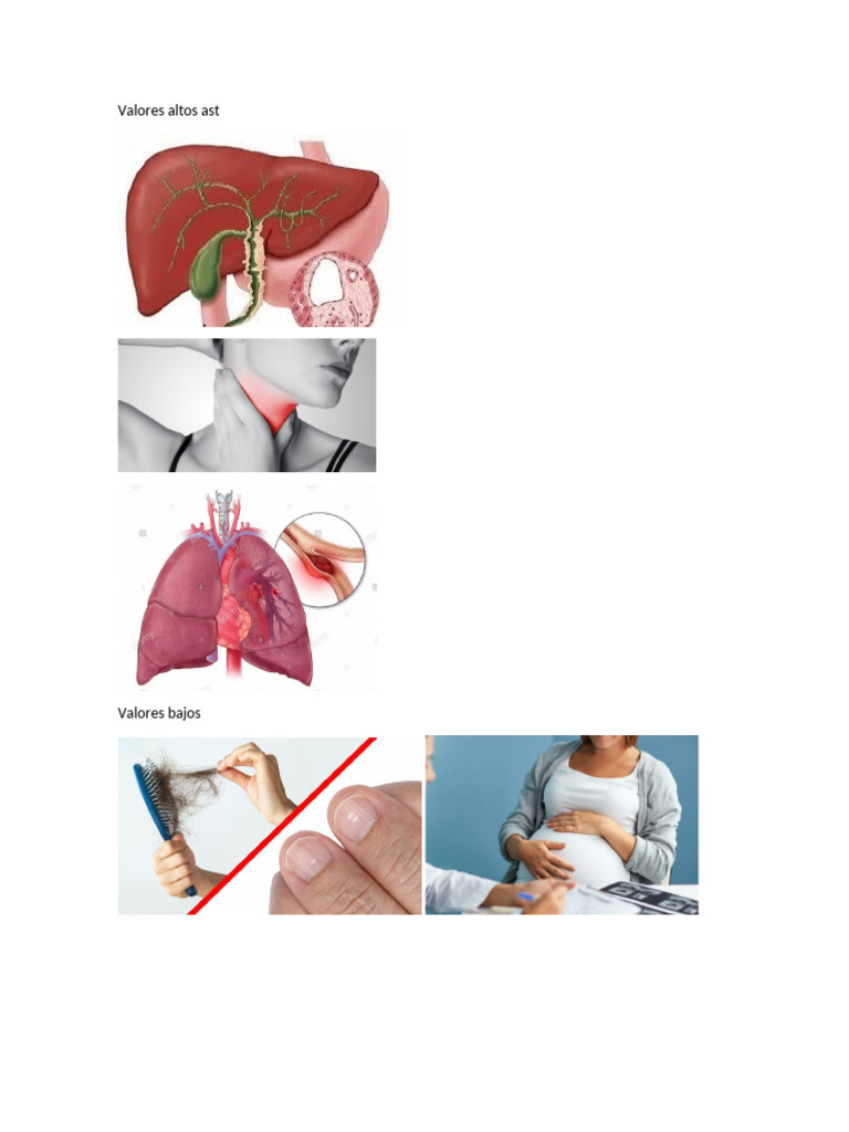 imagenes de ast | PDF