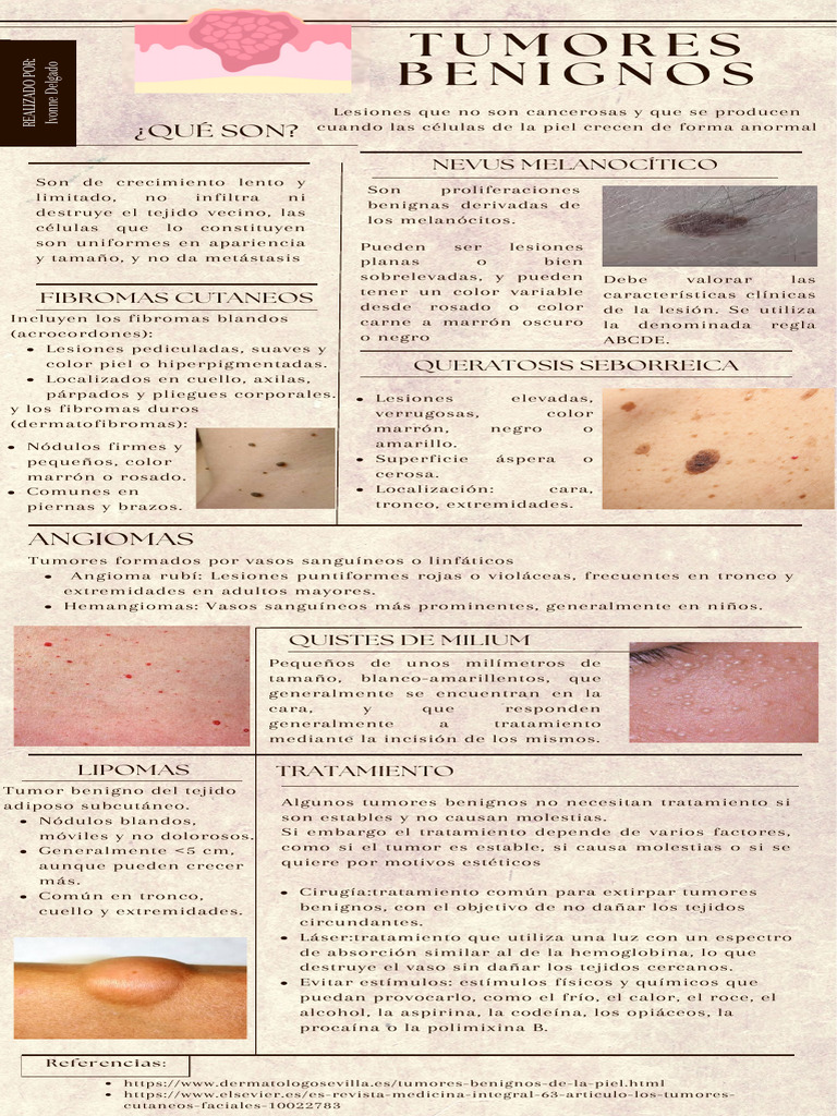Infografía de tumores benignos | PDF | Neoplasias | Medicina CLINICA