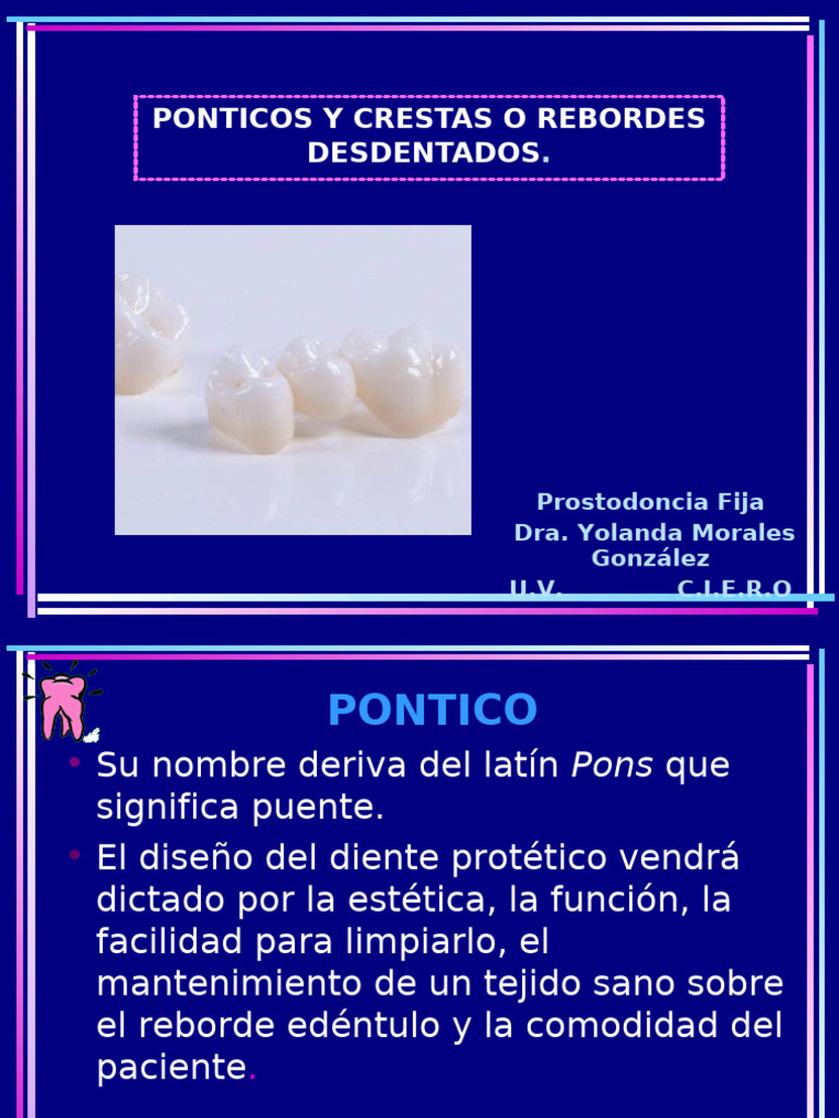 Diseño y Función de Pónticos en Prostodoncia | PDF | Diente