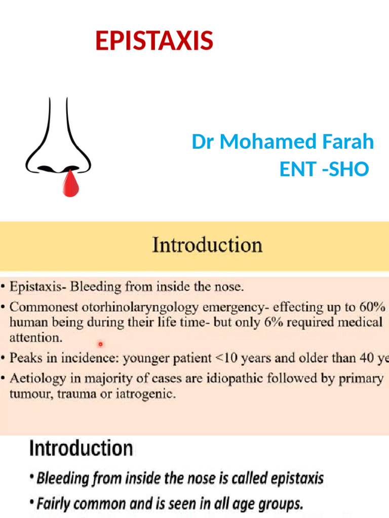 Epistaxis 5.1 | PDF
