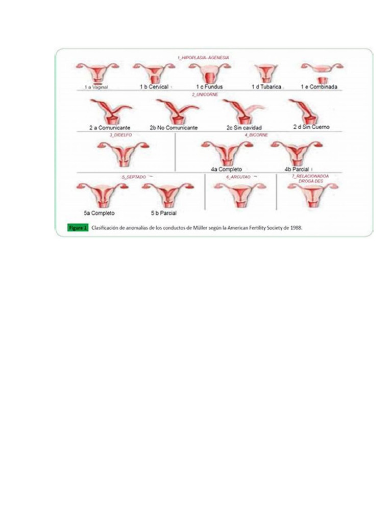Tipos de Utero | PDF