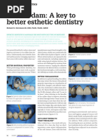 Rubber Dam Setup Techniques Guide | PDF | Dentistry Branches