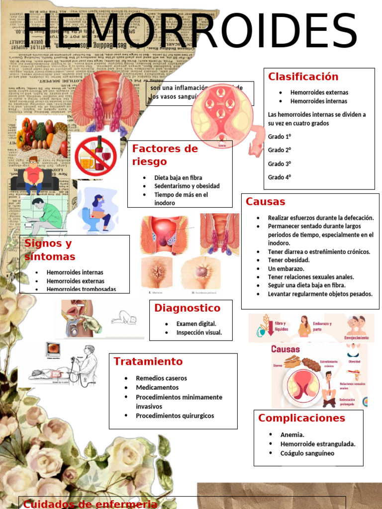Tipos y Tratamientos de Hemorroides | PDF | Hemorroides | Medicina CLINICA
