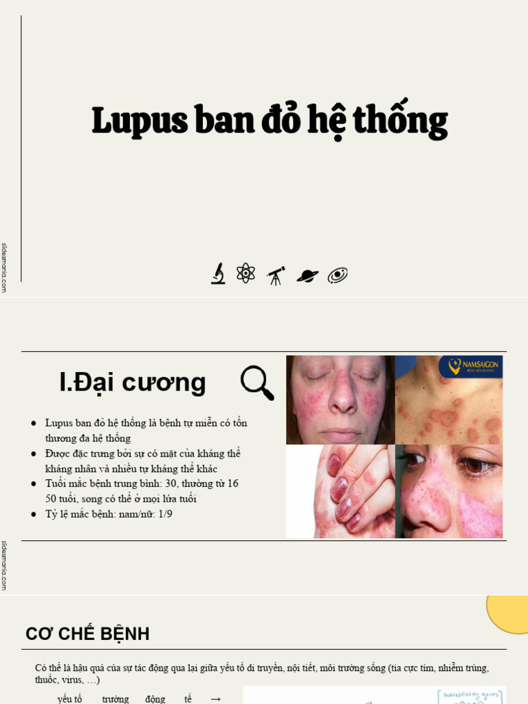LUPUS | PDF