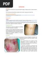 Contusiones y Hematomas: Tipos y Manejo | PDF | Coagulación | Lesión