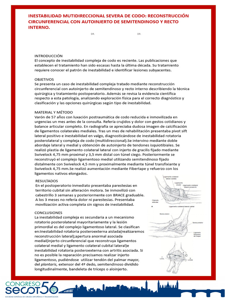 Inestabilidad Mutidireccional Severa de Codo: Reconstrucción ...