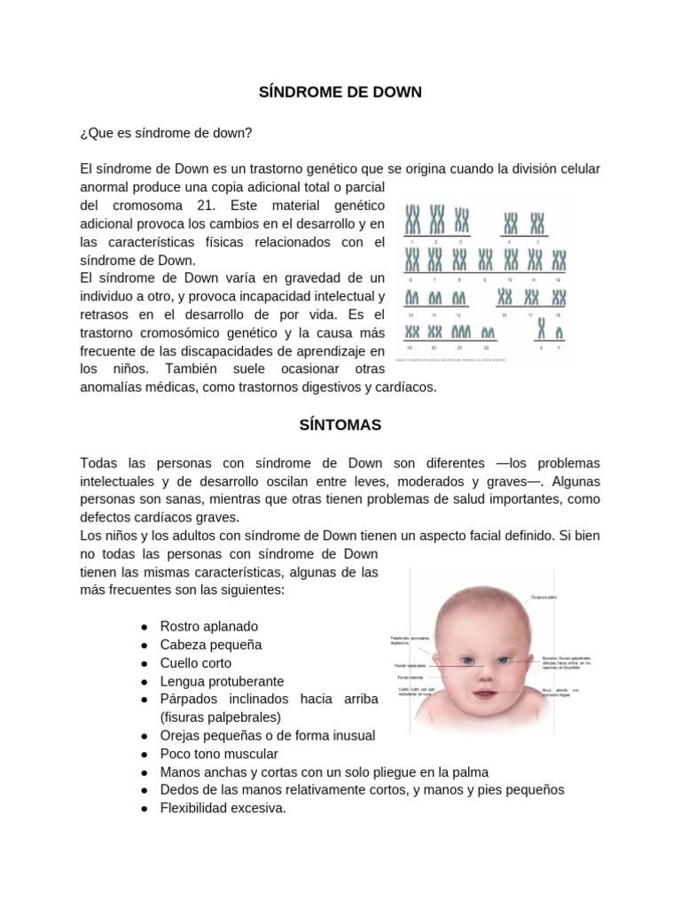 Síndrome de Down: Causas y Síntomas | PDF | Síndrome de Down | Síndrome