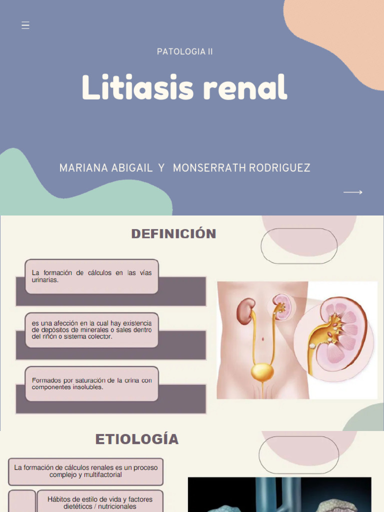 Litiasis Renal: Patología II | PDF