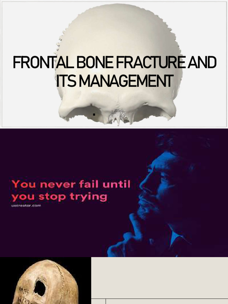 Frontalbonefractureanditsmanagement 230810120501 c63f1916 | PDF ...