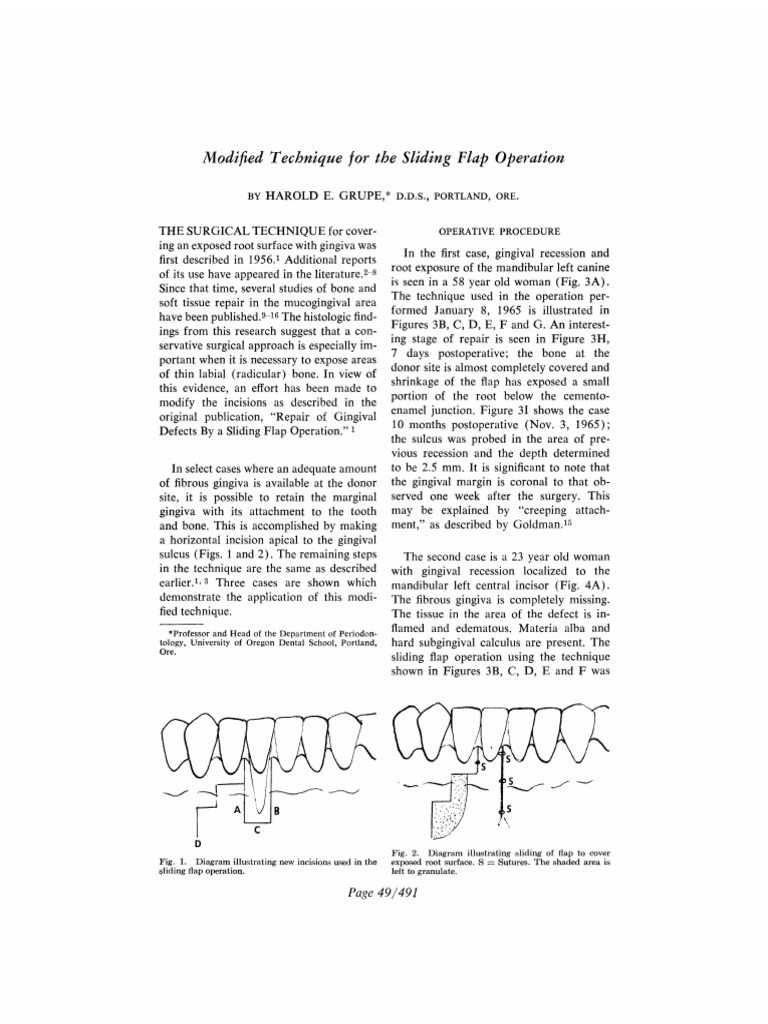 Grupe 1966. Modified Technique For The Sliding Flap Operation | PDF ...