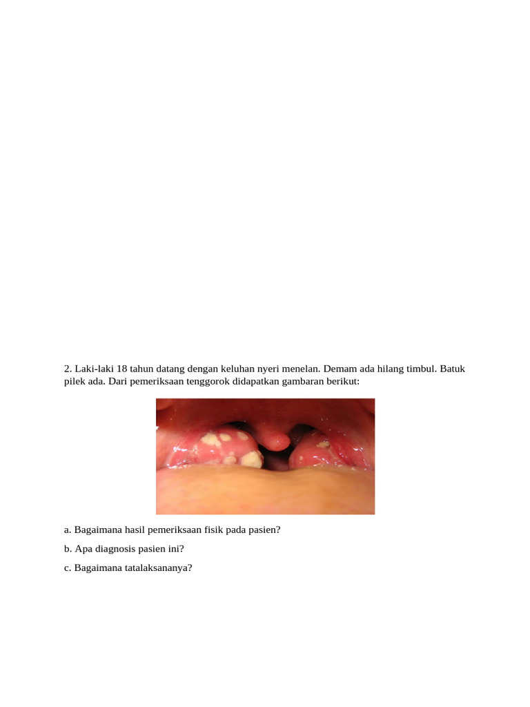 SOAL OSCE THT Tonsilitis | PDF