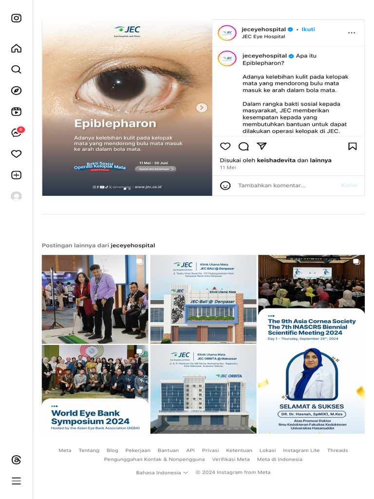 Operasi Kelopak Gratis di JEC | PDF