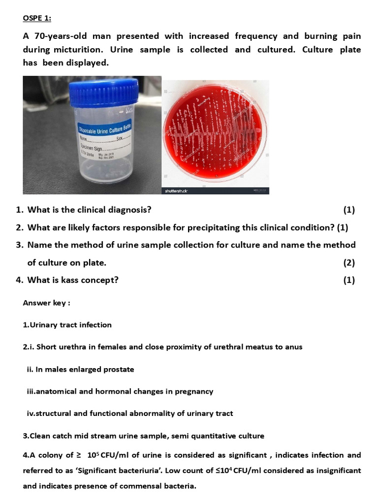 OSPE All Questions With Keys | PDF | Elisa | Hepatitis B