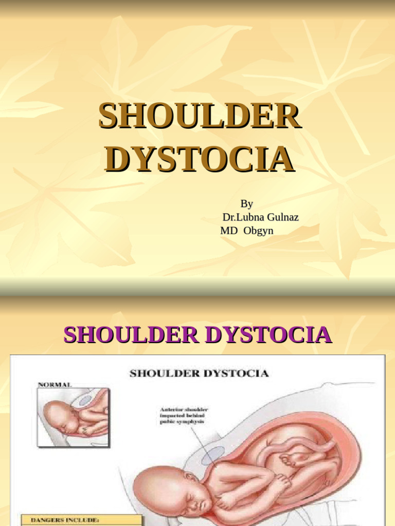 Shoulder Dystocia | PDF | Maternal Health | Medical Specialties