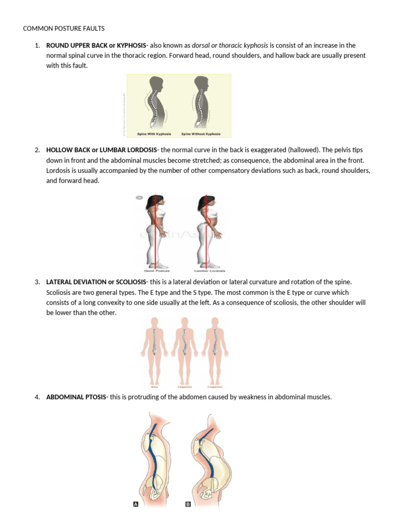 Common Posture Faults 1-4 | PDF