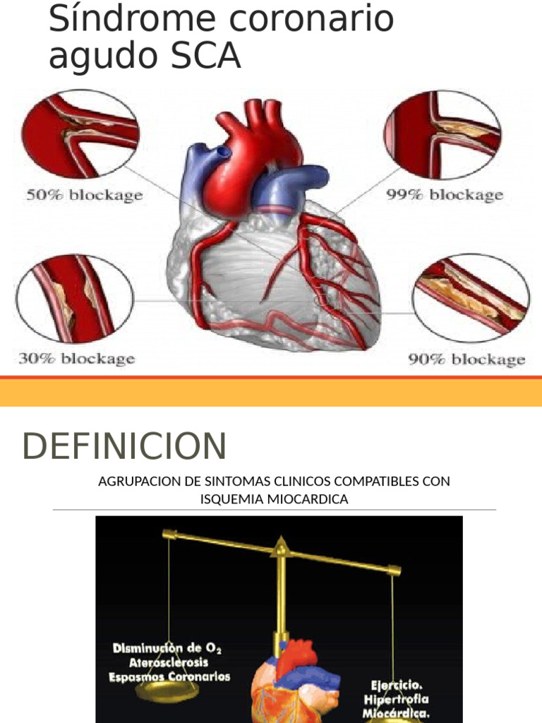 Síndrome Coronario Agudo: Definición y Clasificación | PDF | Isquemia ...