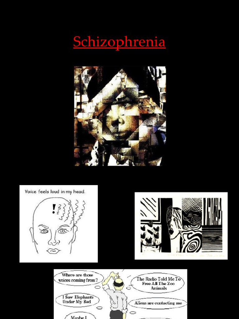 Schizophrenia Ppt. | PDF
