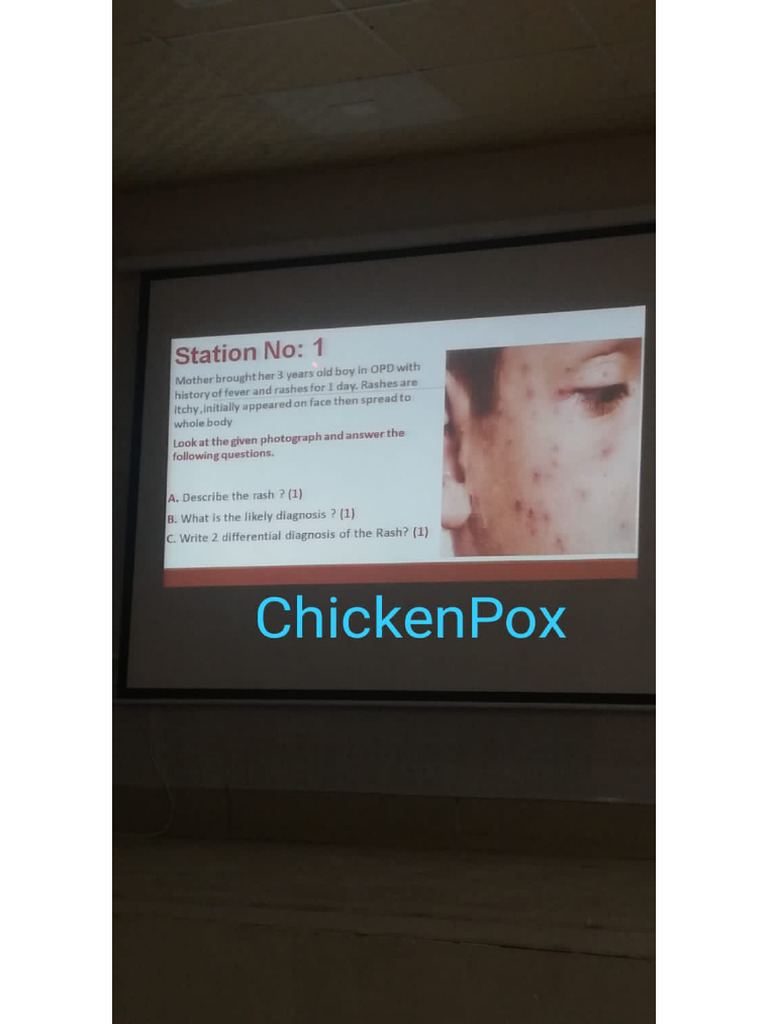 Ospe Peads Collection by Batch 03 | PDF