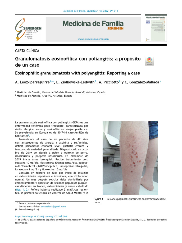 Granulomatosis Eosinofílica Con Poliangitis: A Propósito de Un Caso ...