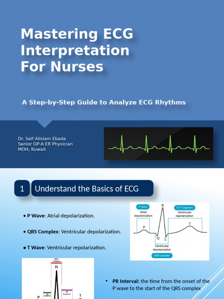 Mastering ECG Interpretation For Nurses | PDF | Electrocardiography | Electrophysiology