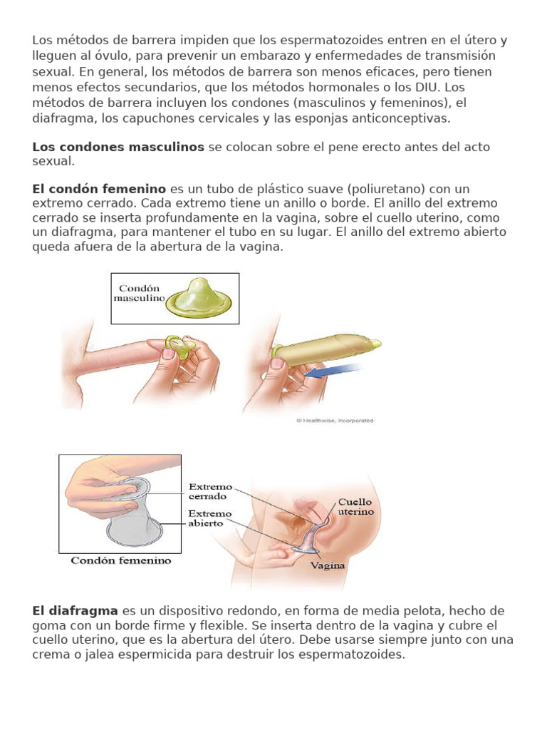 metodos de barrera | PDF