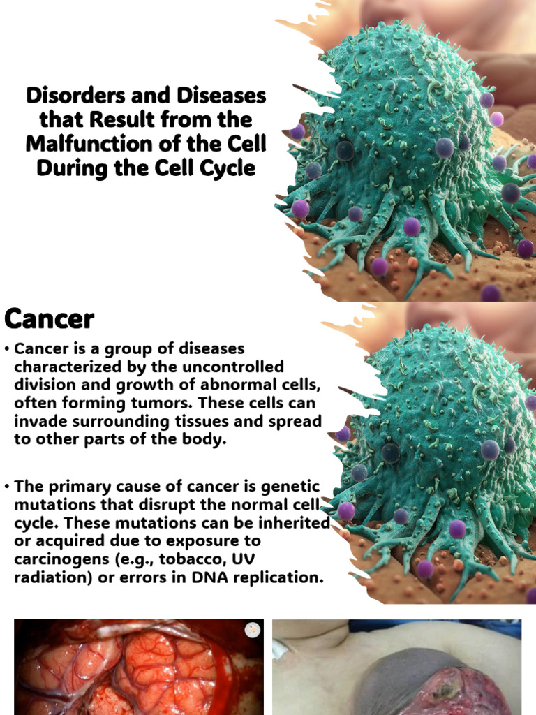 Cell Cycle Disorders and Cancers | PDF | Cancer | Genetic Disorder
